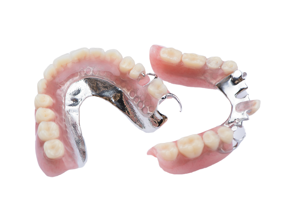 Removable Partial Denture